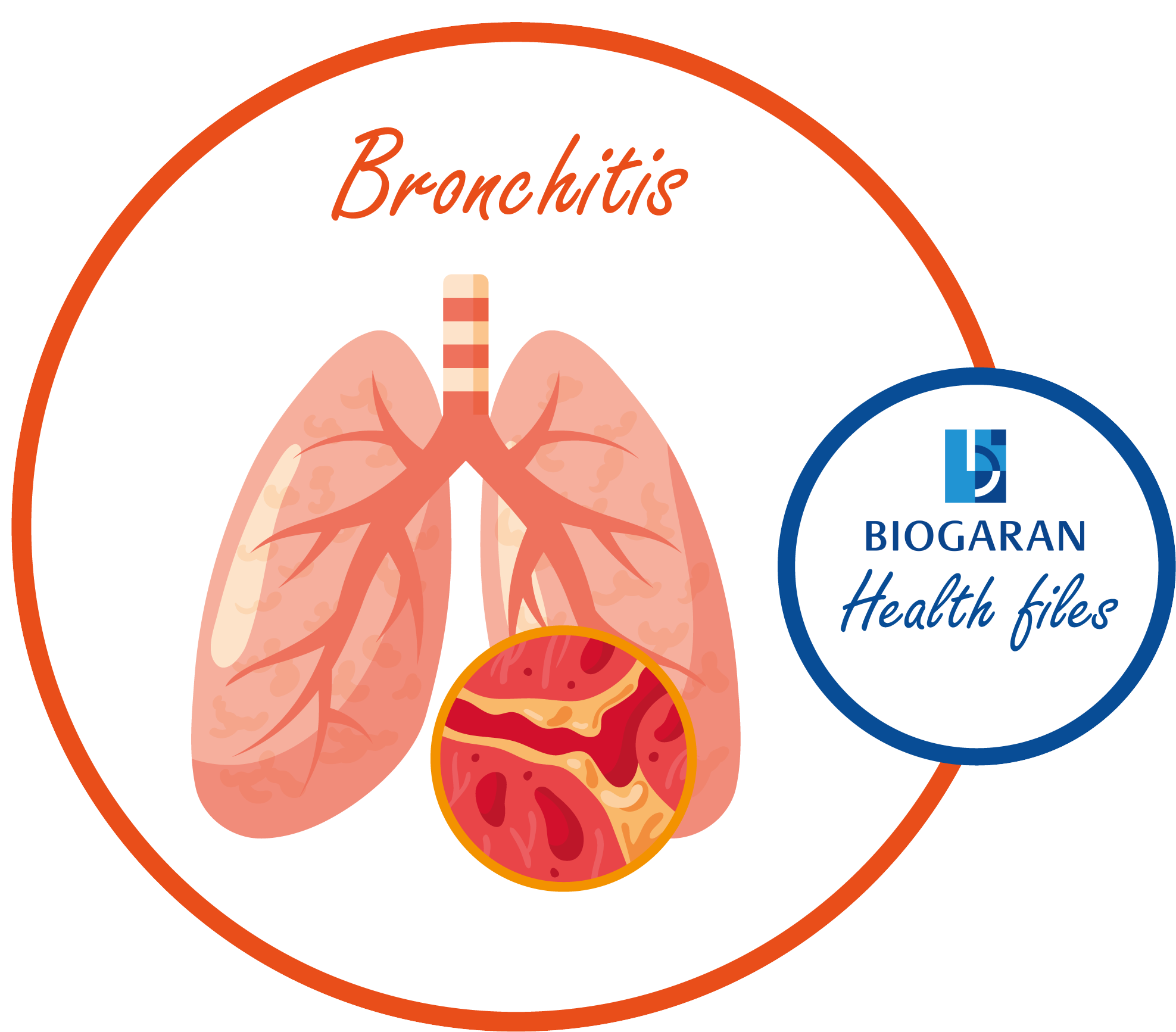 Respiratory infections #1: Bronchitis - Biogaran Middle-east